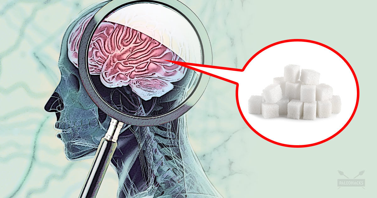 Alzheimer's and Sugar: How Too Much Sugar May Increase Your Risk