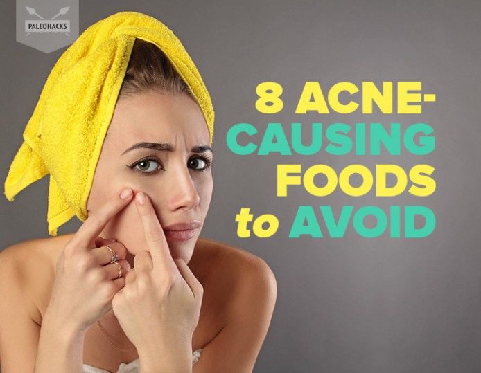 8 Acne-Causing Foods You Need to Avoid for Clearer Skin
