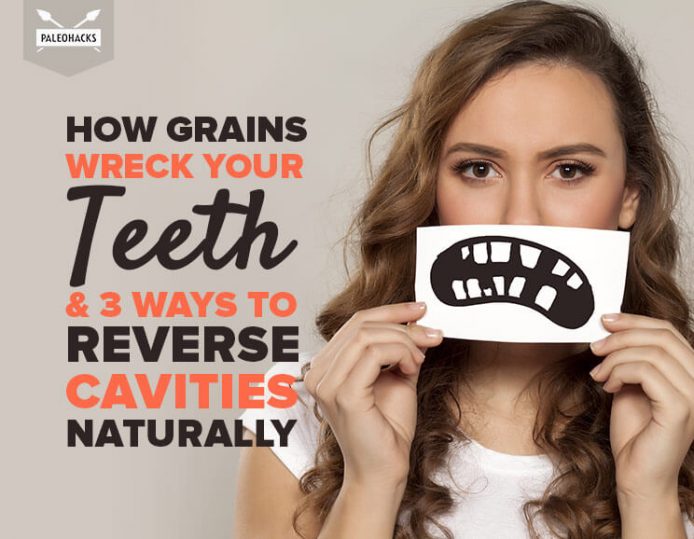 How Grains Wreck Your Teeth & 3 Ways to Reverse Cavities Naturally