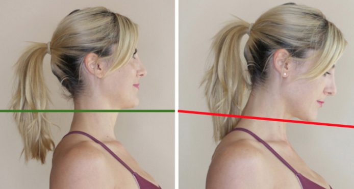 How to Fix Text Neck in 3 Easy Steps + 6 Neck Stretches & Exercises